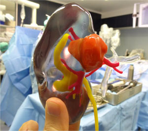3d Printed Kidney