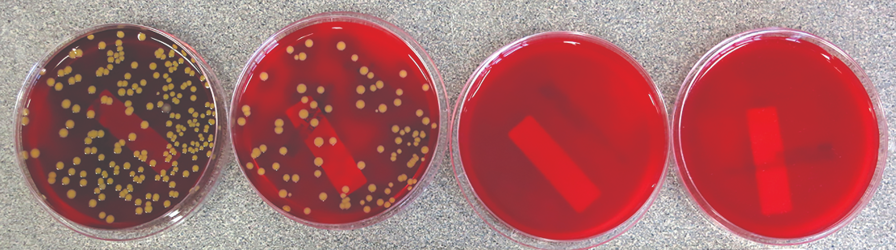 Antimicrobial Coating for Medical Devices - Stratasys