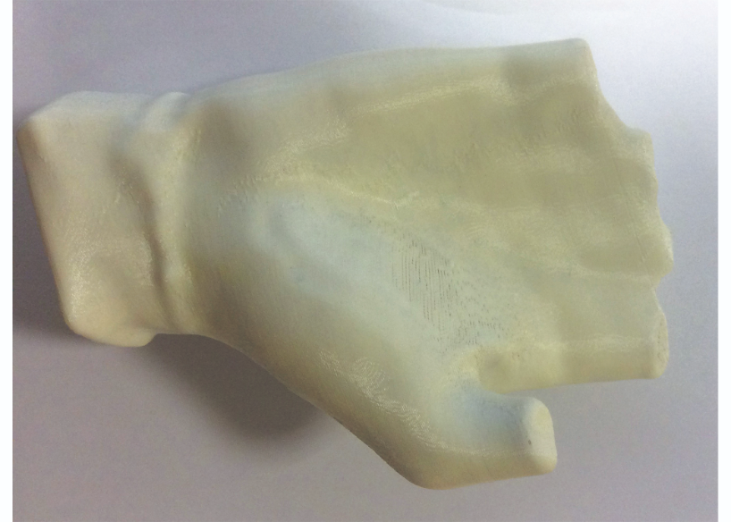 Prosthetic Molds Achieve New Fit with 3D Printing
