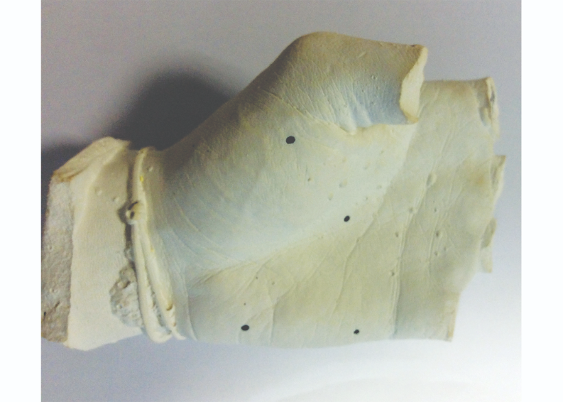 Prosthetic Molds Achieve New Fit with 3D Printing
