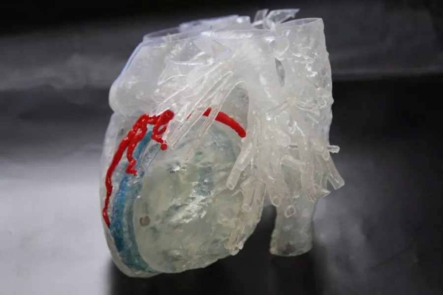 Forming the Safest Surgical Plan - Case Study