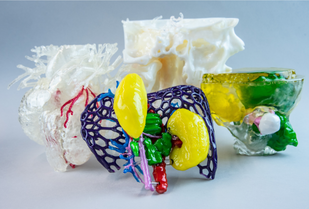 Patient-Specific Medical Device Development - How to Introduce and ...