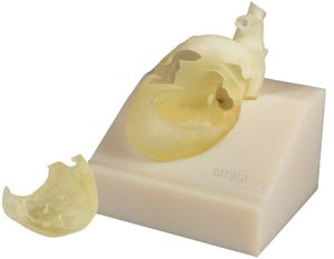 How Do 3D Printed Heart Models Impact Surgery