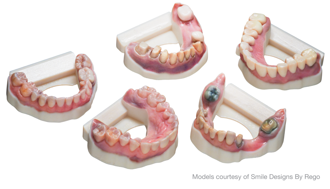 Stratasys and 3Shape introduce new automated digital color workflow for ...