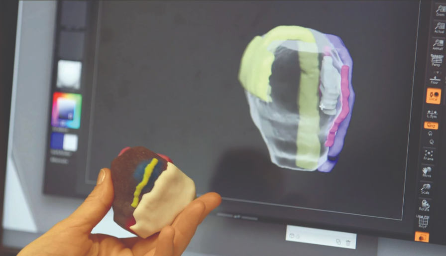 Establishing New Standard of Patient Care with 3D Printing