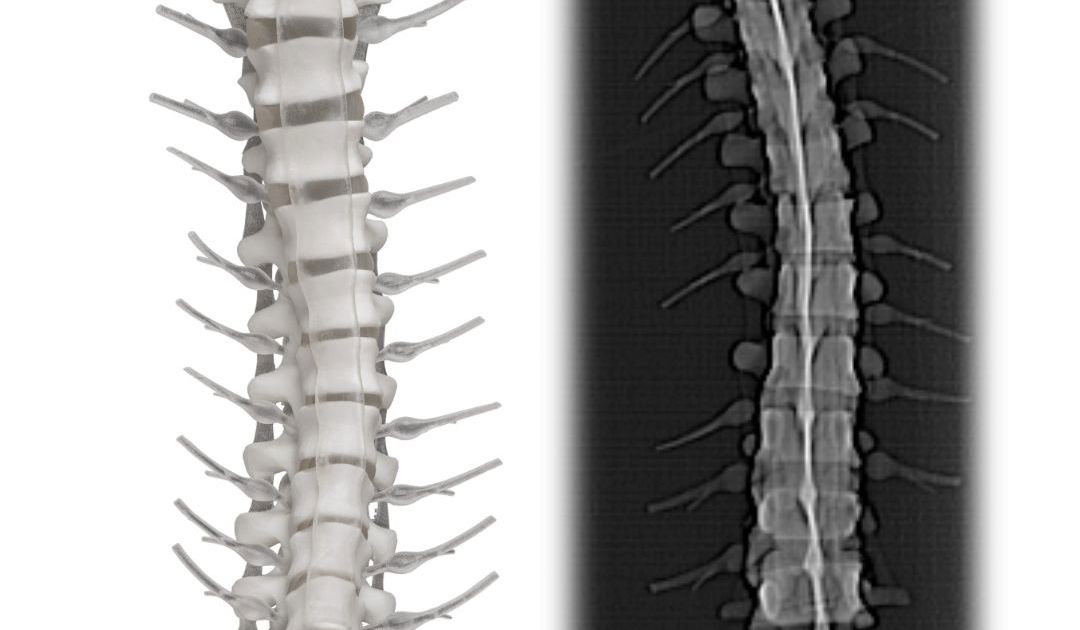 RadioMatrix™: Radiopaque Material For 3D Models - Stratasys