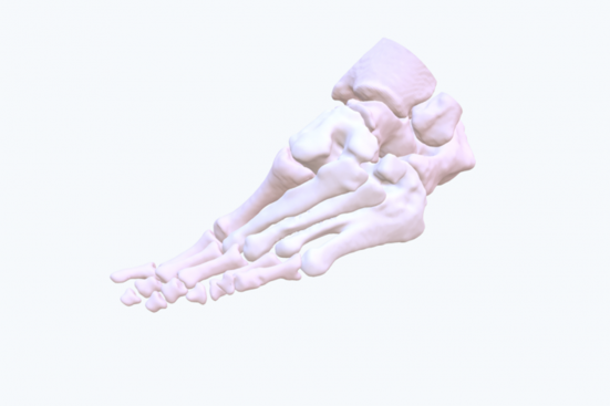 Creating a Surgical Plan with 3D Anatomical Models