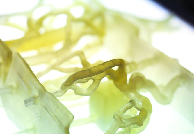 Revolutionizing Medical Devices - stratasys