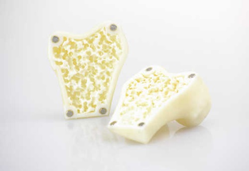 Medical Parts & Models | On Demand 3D Printing | Stratasys Direct